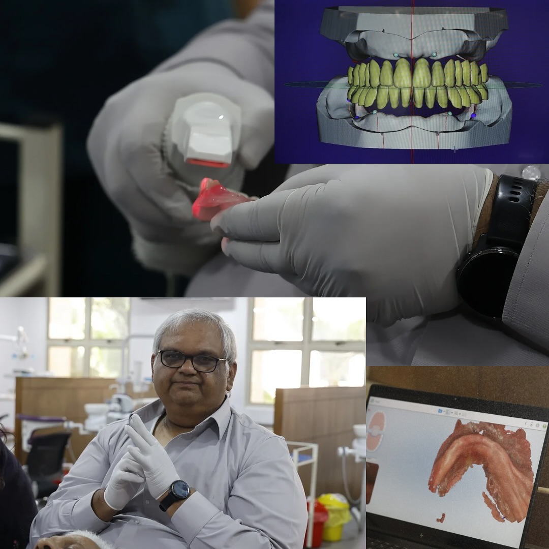 Digital Dentistry 3.0 – Innovation in Prosthodontics at Karnavati ...